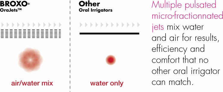 LES BONNES AFFAIRES DU NET: Broxo® Jet - Orajets® Dental irrigator ...