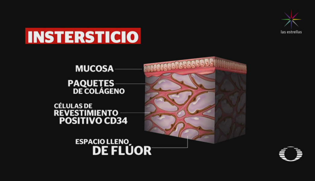 Acorde con la vida: Noticias Médicas: "El Intersticio, el ...