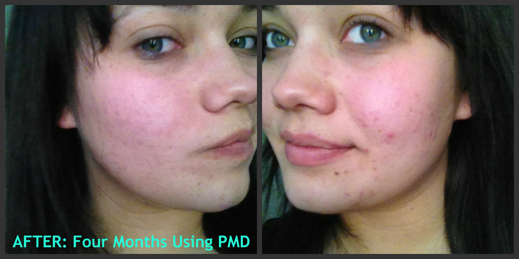 ThatGirlShaes Blog!: PMD Update