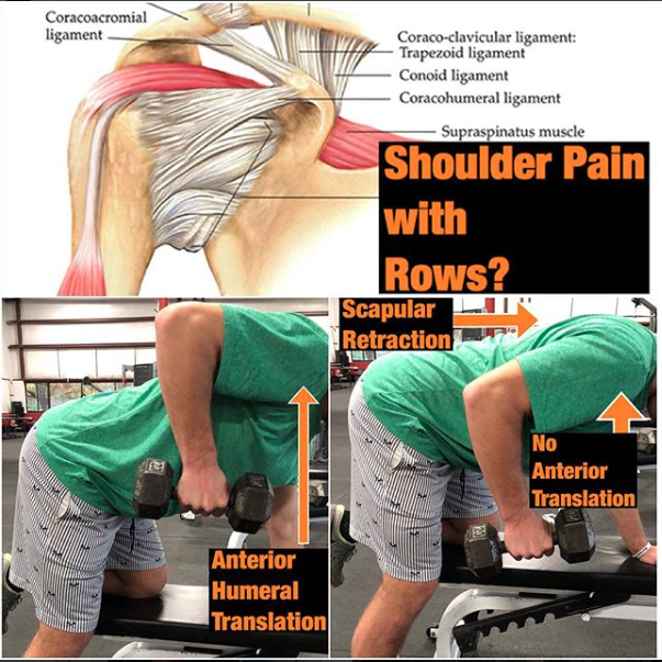 Shoulder / ПЛЕЧИ: Shoulder Pain with Rows?