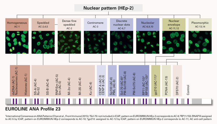 Medical Microbiology: Lab Series #16: Anti Nuclear antibodies
