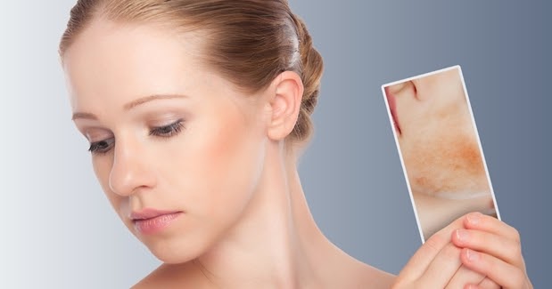 Cara Mengembalikan Wajah yang Rusak Akibat Cream dan Kosmetik ...