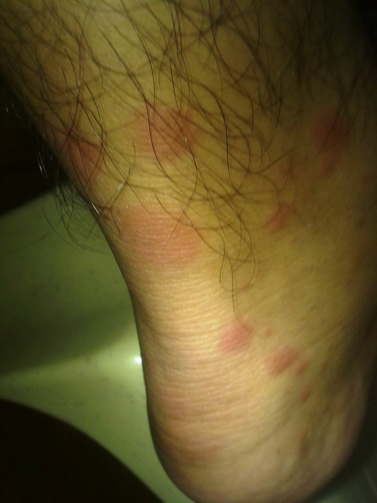 The JAKE POSITIVE BLOG: 2ND WEEK AND 3RD WEEK OF ARV TRIAL