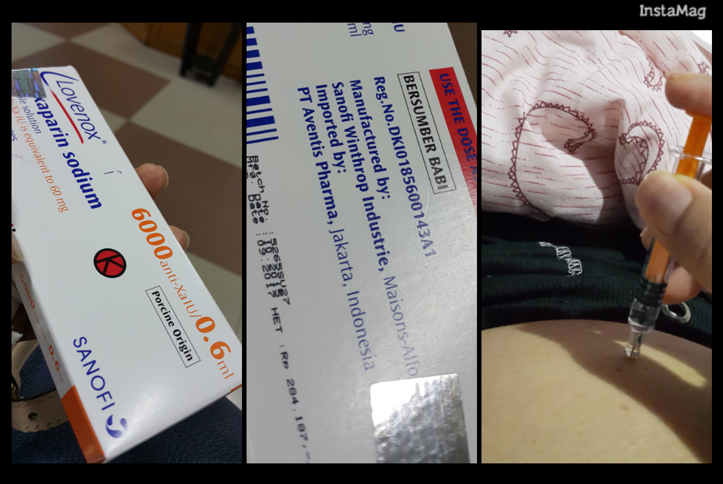 Berhasilnya penantian panjang melalui program bayi tabung (IVF ...