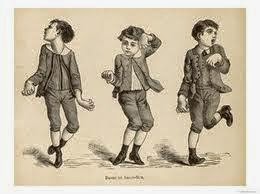 La Marcha Humana: Marchas Patológicas