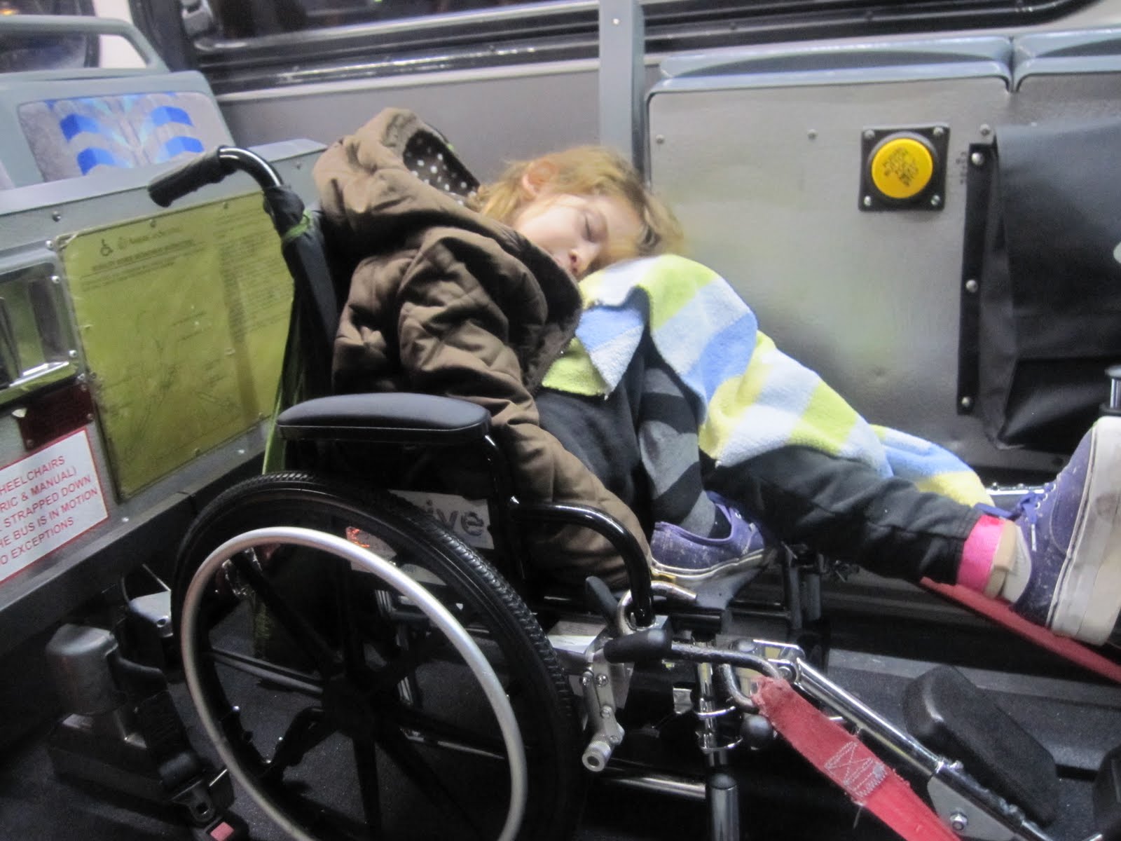 Amaya's Journey with PFFD: Dolphin Tale