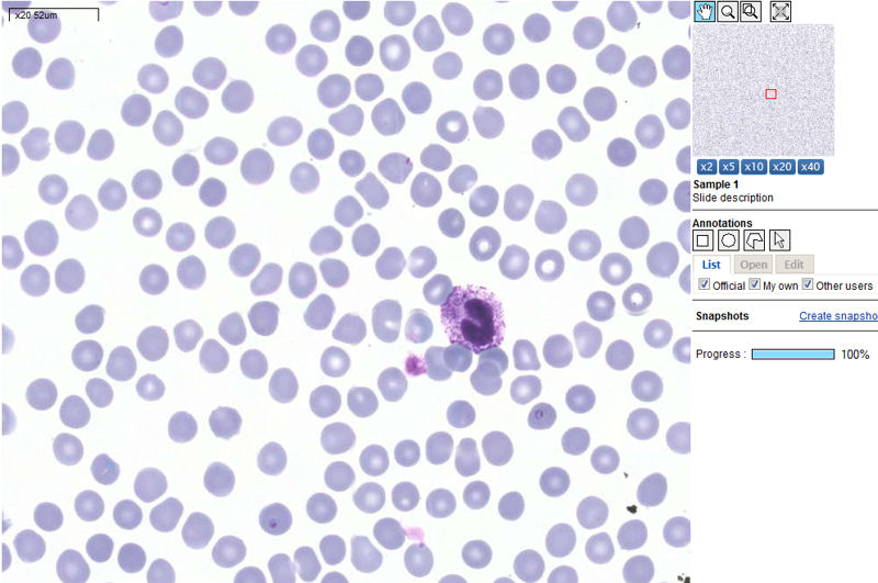 Medical Laboratory and Biomedical Science: Virtual Microscopy for ...