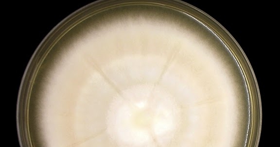 Fun With Microbiology (What's Buggin' You?): Microsporum audouinii