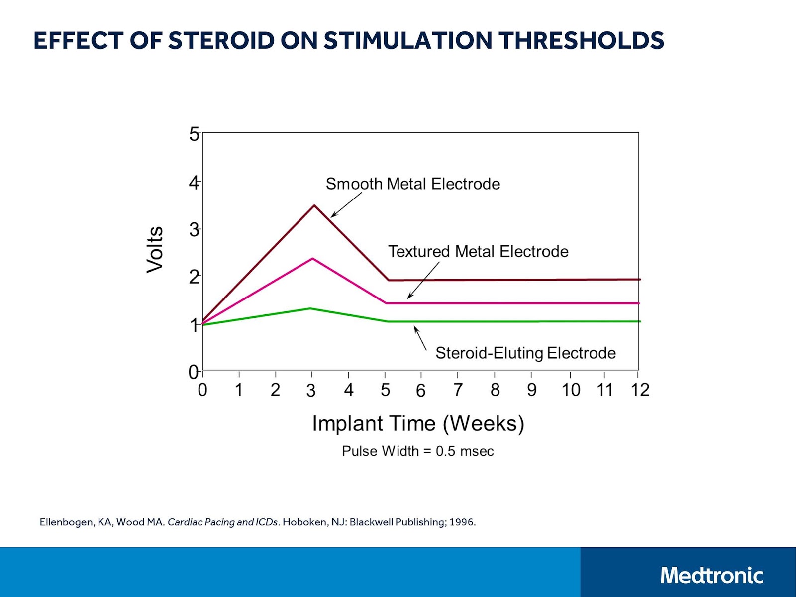 CVT Mohd Farid: Basic Pacing Concepts Part II-Medtronic Academy