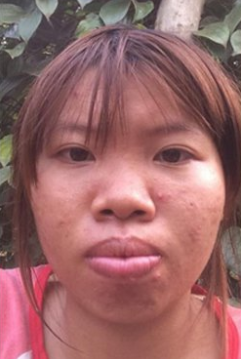 This Woman Grew Up Insulted for Being ‘Ugly’, Finally Gets Her Happily ...