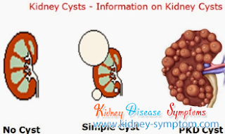 treatment for kidney disease: Complications of Renal Cysts (Kidney Cysts)