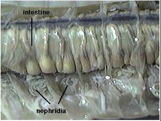 Bio 11 Blog: Earthworm Dissection