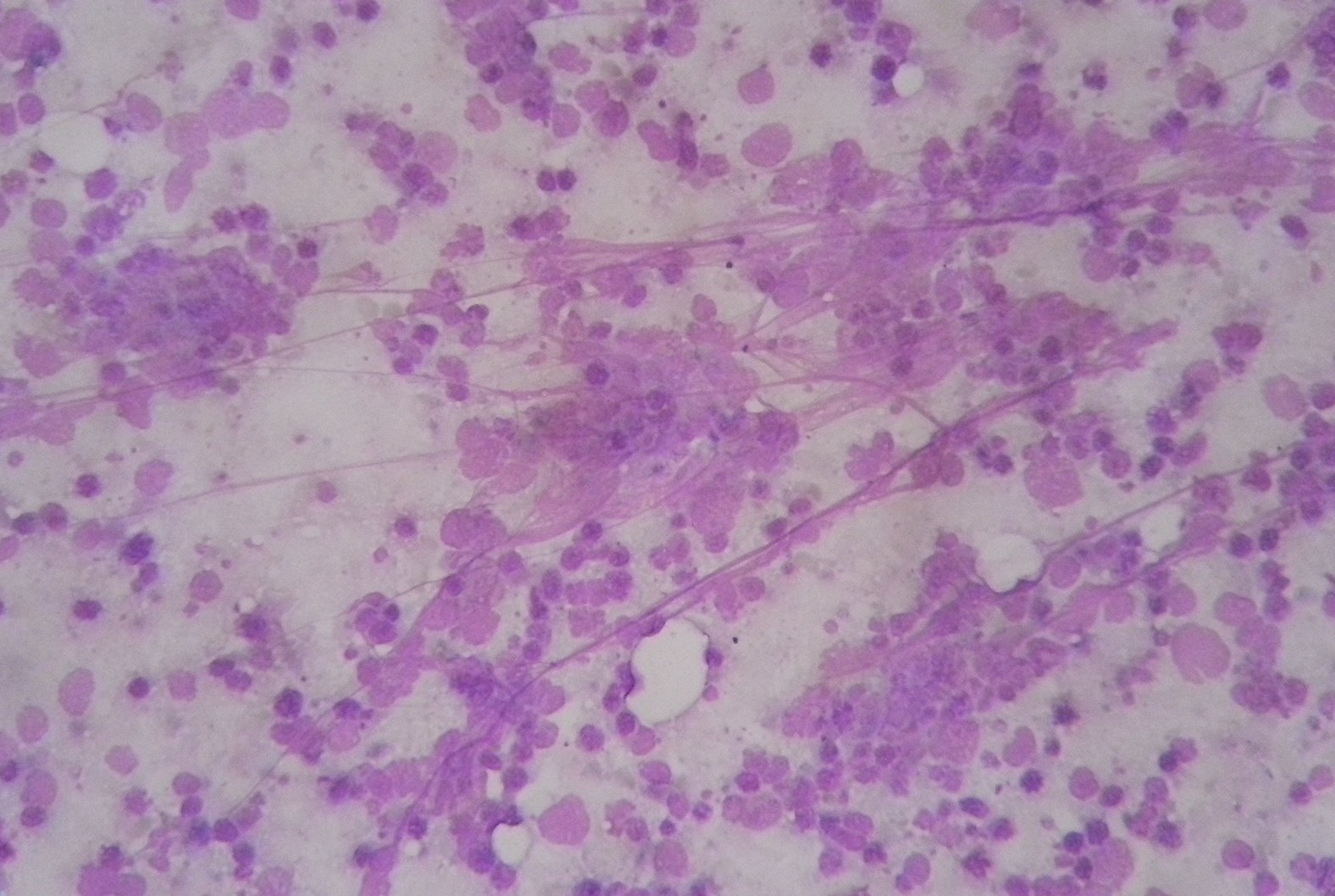 into the roots: Lung cytology