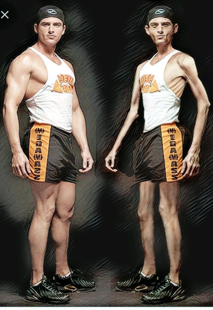 Você sabe o que é Dismorfia Muscular?