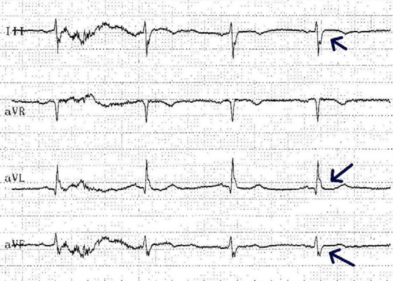 Dr. Smith's ECG Blog