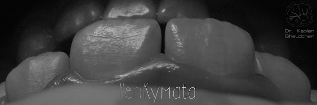 PeriKymata