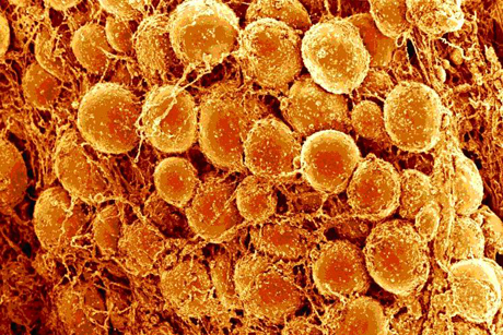 Healthy Sustainable Living: Contrary To Popular Belief, Adults Can ...