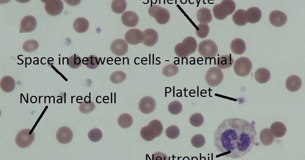 Medical Laboratory and Biomedical Science: A Pale Child
