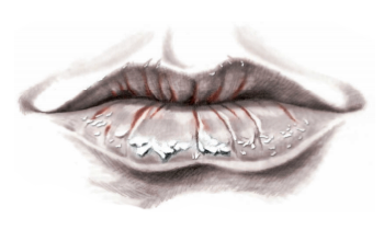 A lip scrub that will transform your cracked painful winter lips in ...