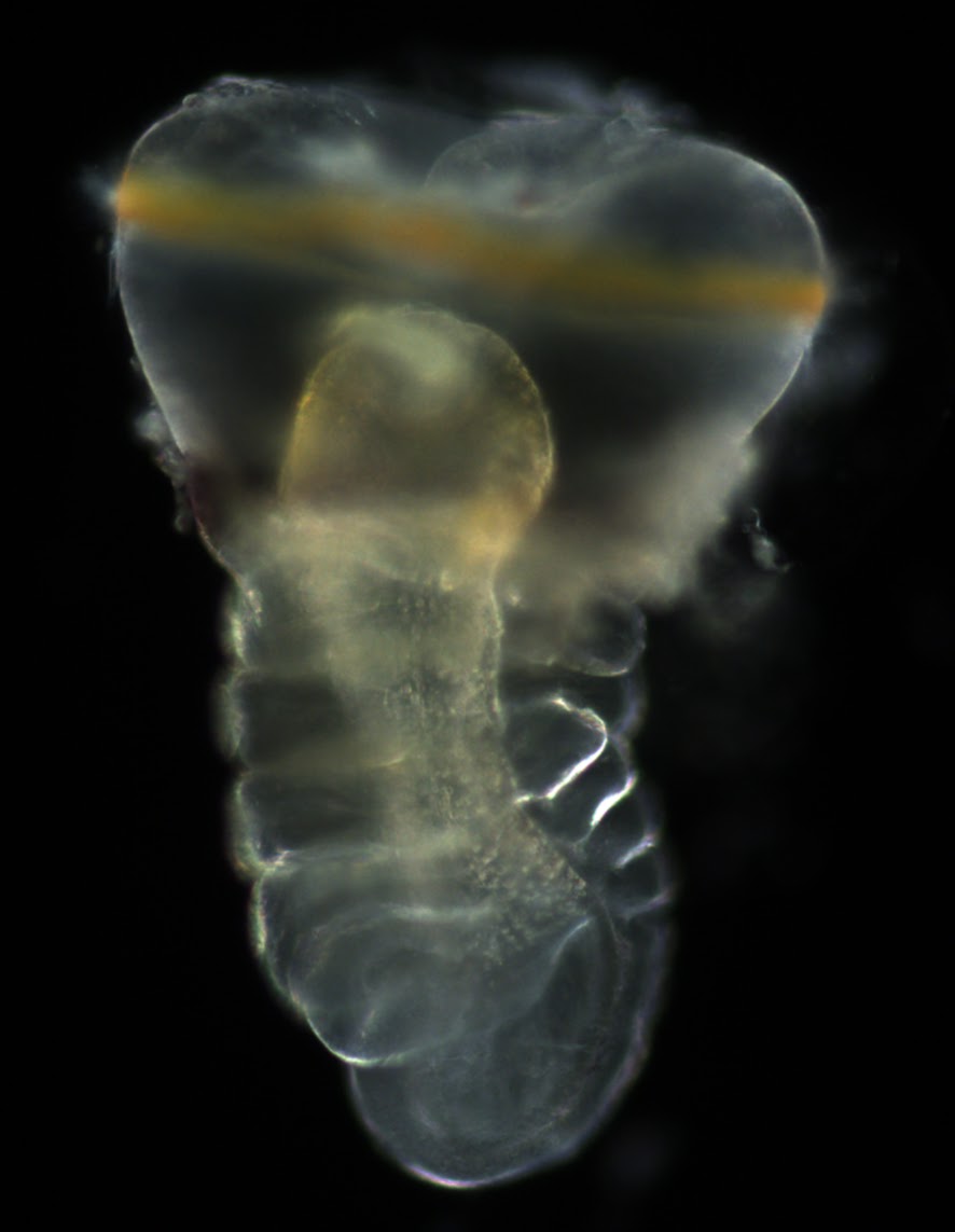Invertebrate Embryology: Larva of Polygordius sp.