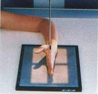 Radiology Squad: Teknik Pemeriksaan Radiografi Ossa Manus