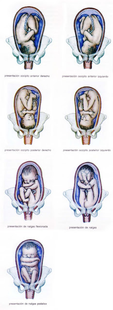 EMBARAZO ADOLESCENTE: POSICIONES DEL BEBÉ ANTES DEL PARTO