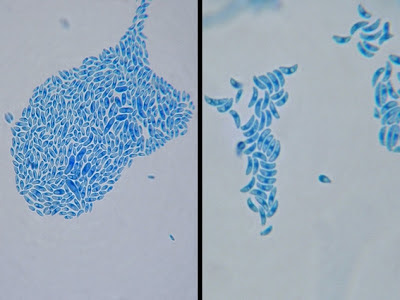 Fun With Microbiology (What's Buggin' You?): Fusarium oxysporum