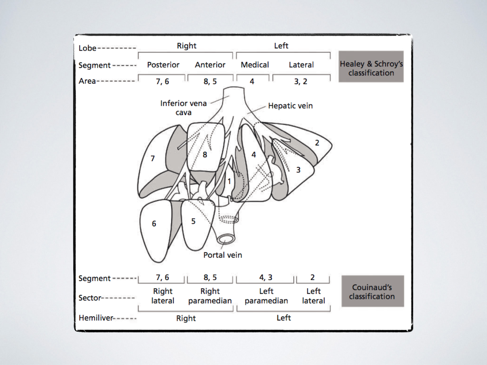 Cuadernos de Anatomía Quirúrgica: Segmentación hepática en ecografía.
