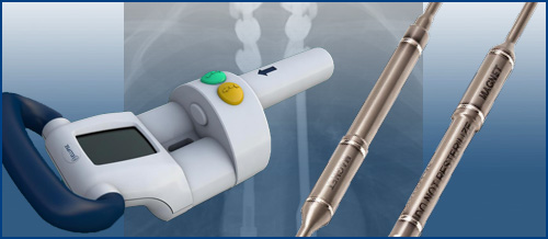 MAGEC Growing Rods (Part 1) | Growing Spine Blog | Washington ...