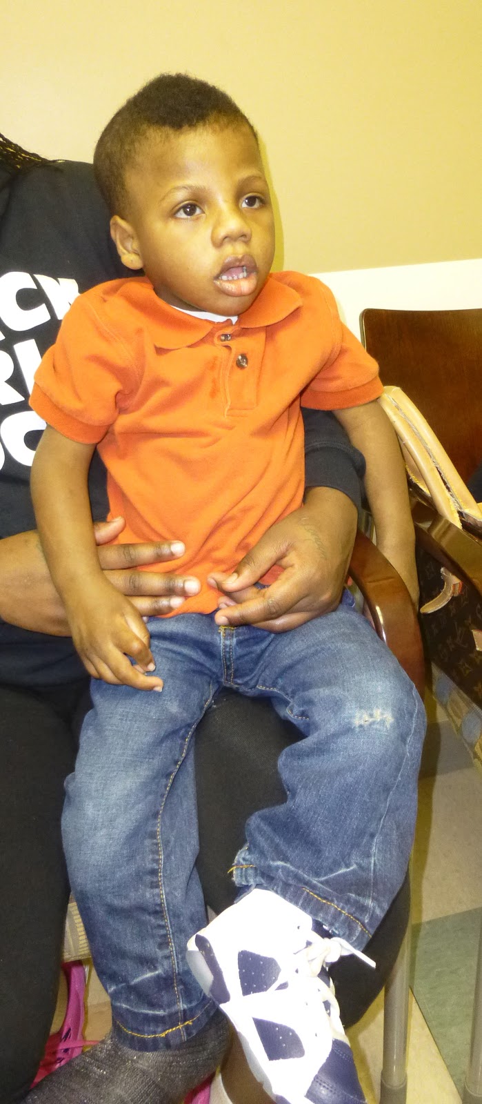 Trisomy 8 | Congenital Hand and Arm Differences | Washington University ...