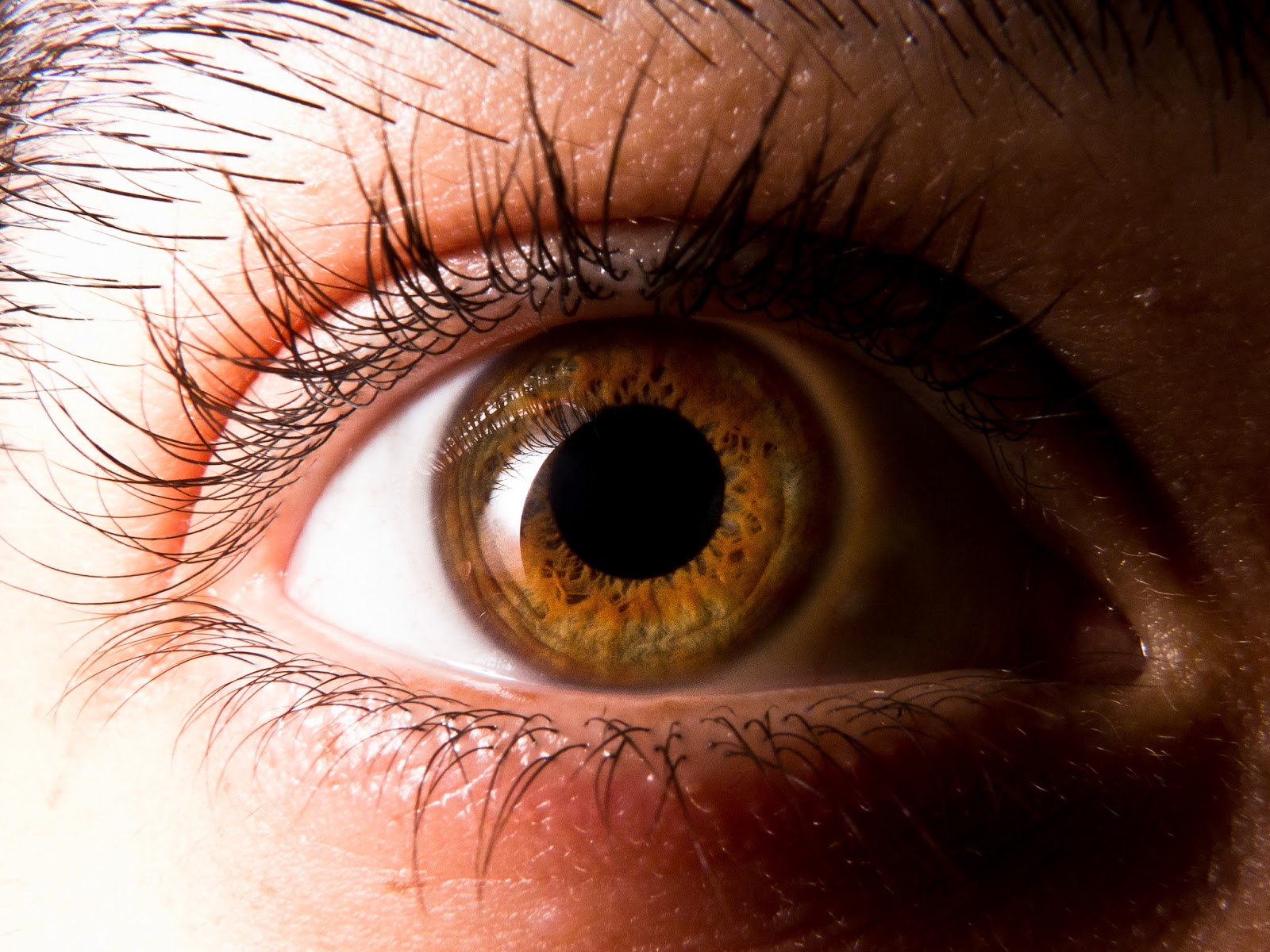 Ametropías: defectos de la visión