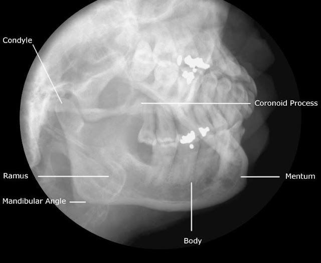 August 2013 ~ stomatologist / Dental