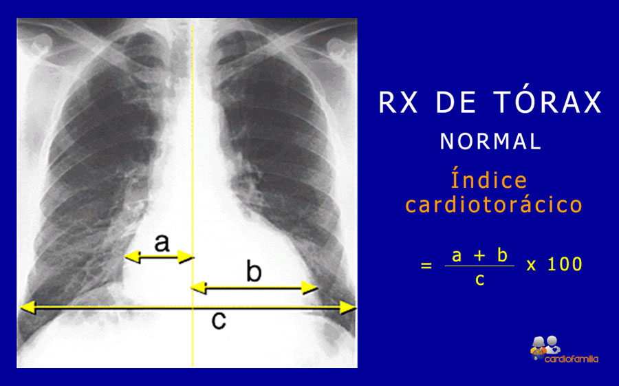 katherine Massiel (semiologia quirurgica): EXAMEN DEL TORAX