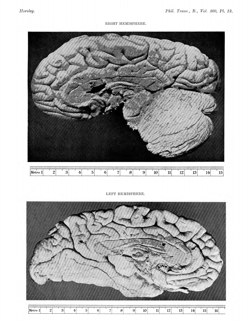 Charles Babbage Brain