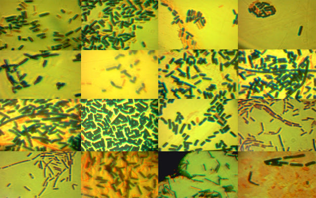 LABORATORIO Y MICROBIOLOGÍA: FOTOS DE CLOSTRIDIUM SP