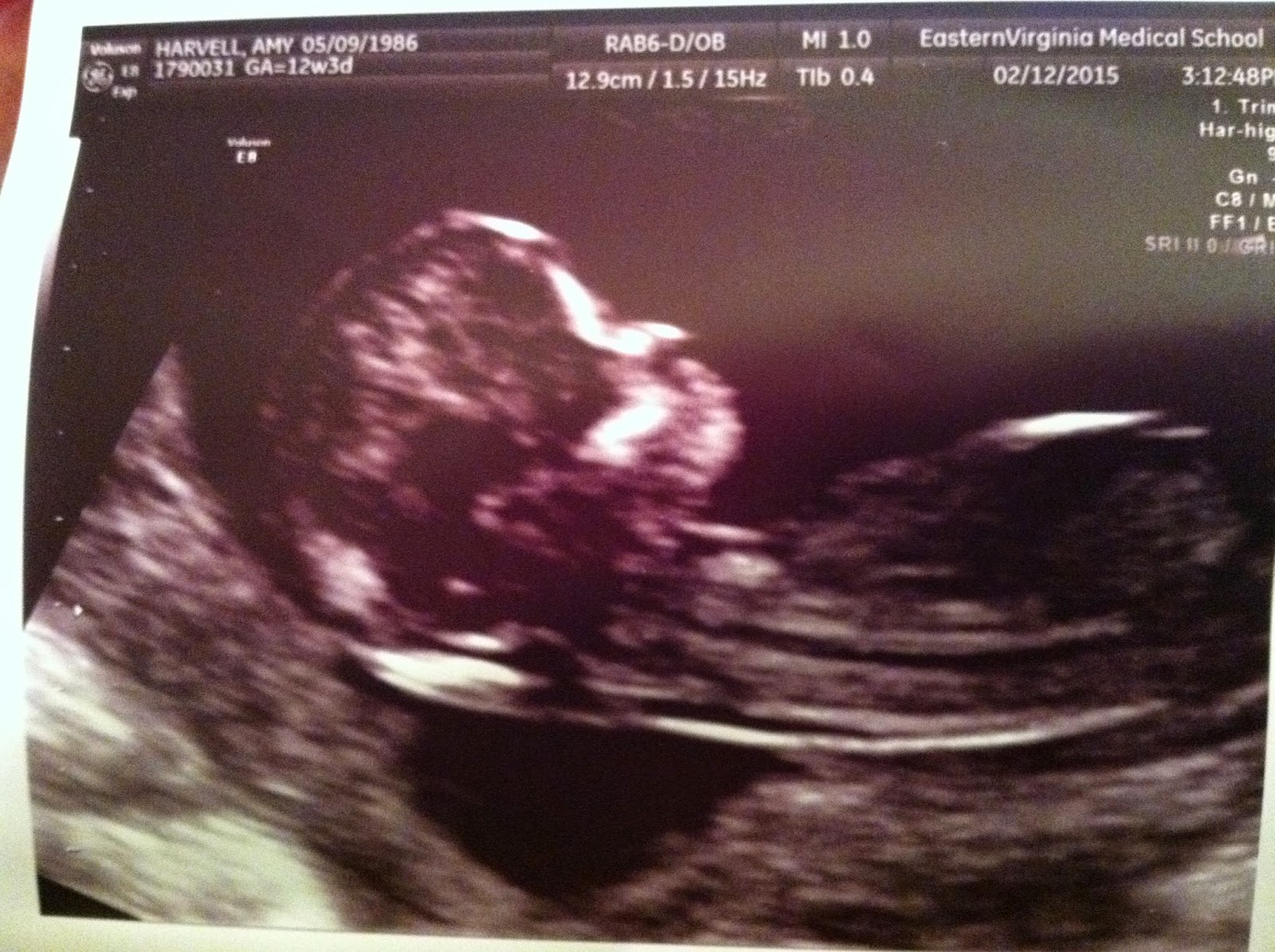 The Harvell Family: Baby Bump - Months 1-3