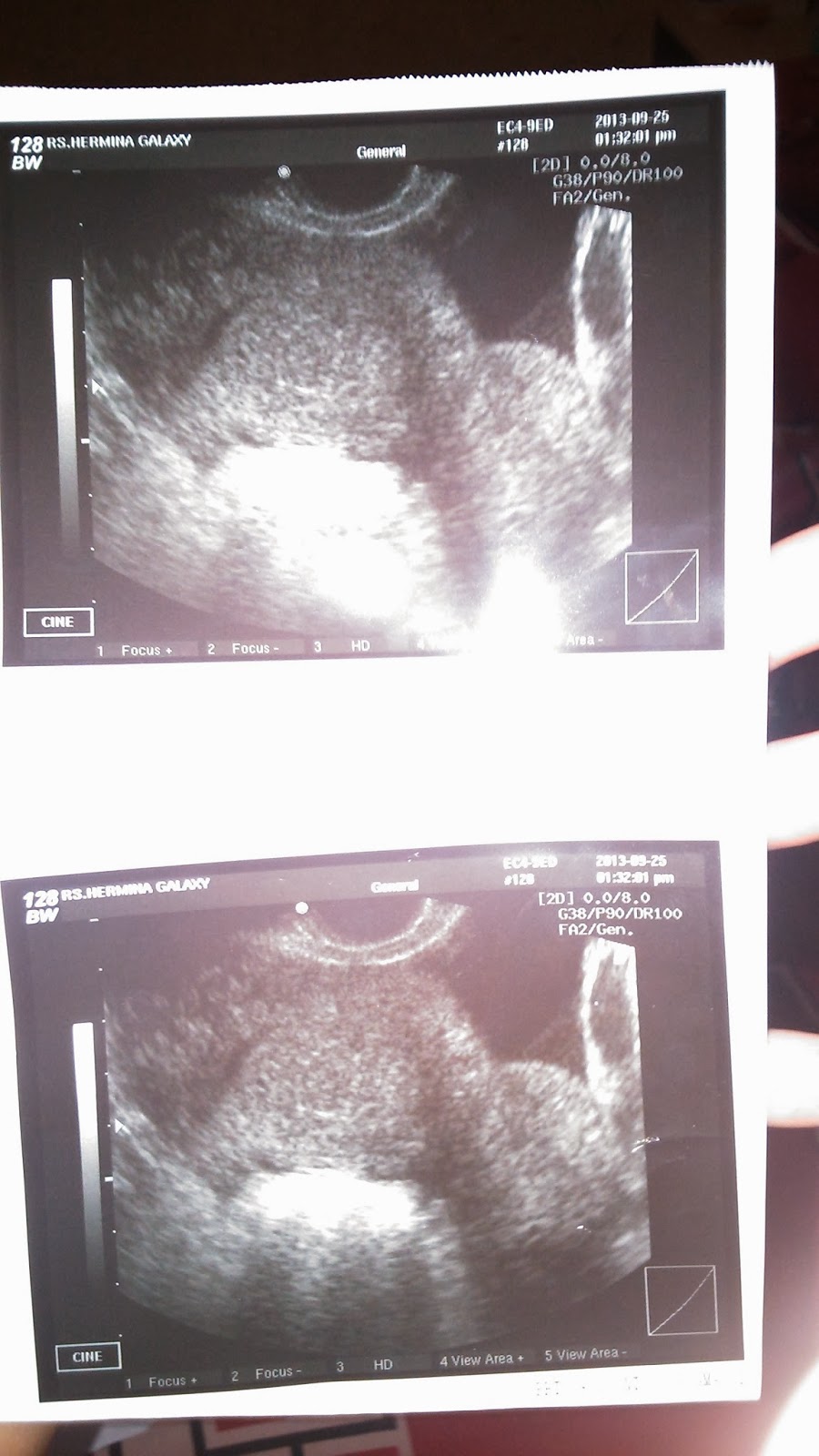 Another day, another blessing..: Dr. Femmy Zulkarnain (RSIA Hermina Galaxy)