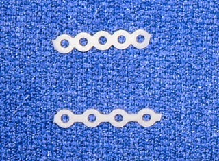 Jaw Surgery Journey: June 2014