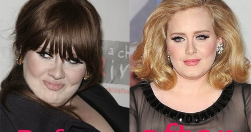 Adele Before And After Nose Job