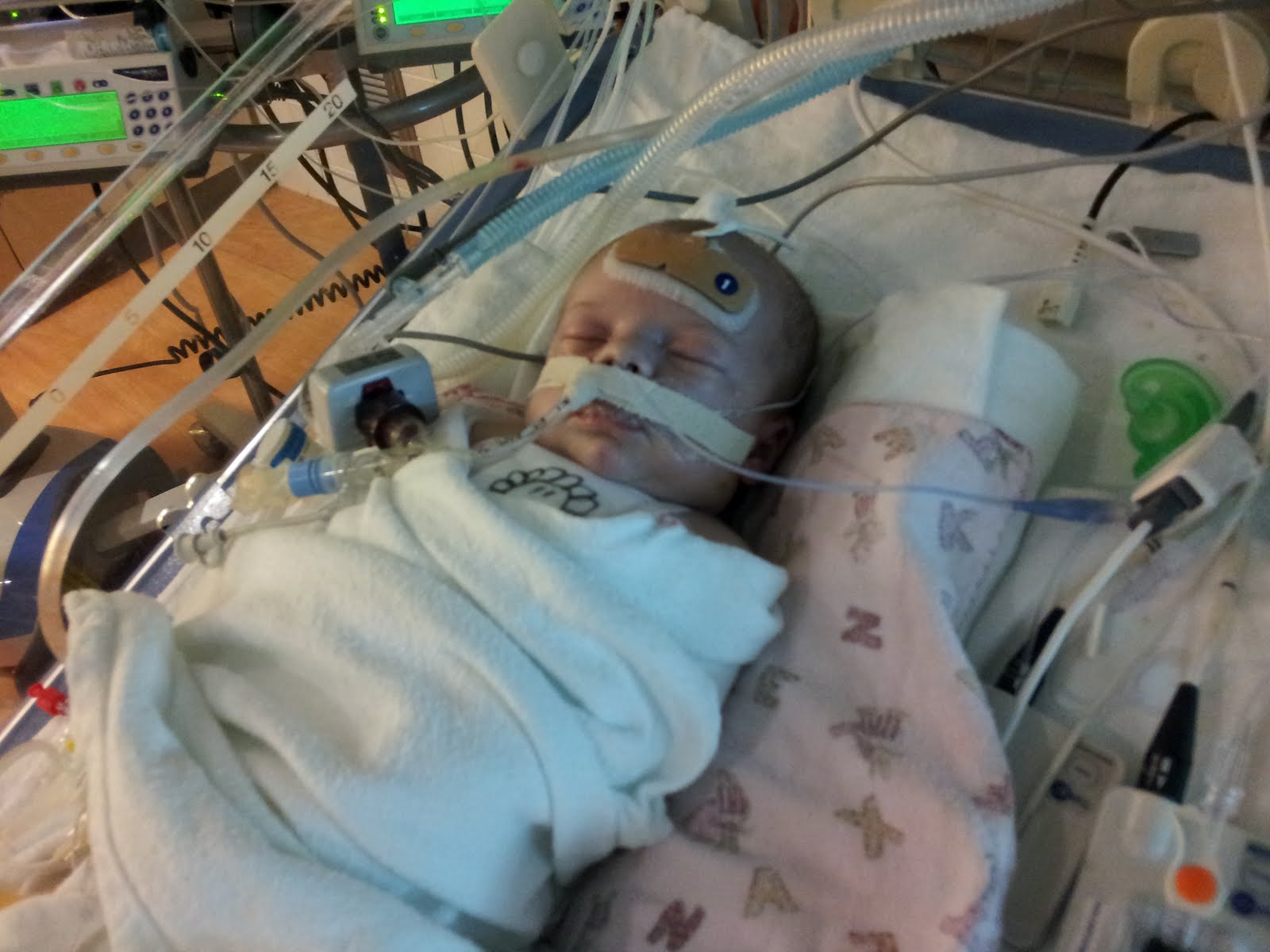 Baby Katherine - Pure of Heart: Katie's Life In Pictures - CVICU: Post ...