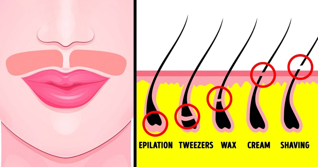 Best Tips! See How to Permanently Remove Hair from Your Body Parts in a ...