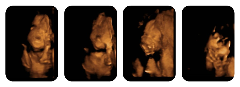 Bekkas blogg: 3D/4D Ultraljud idag :) (25+3)