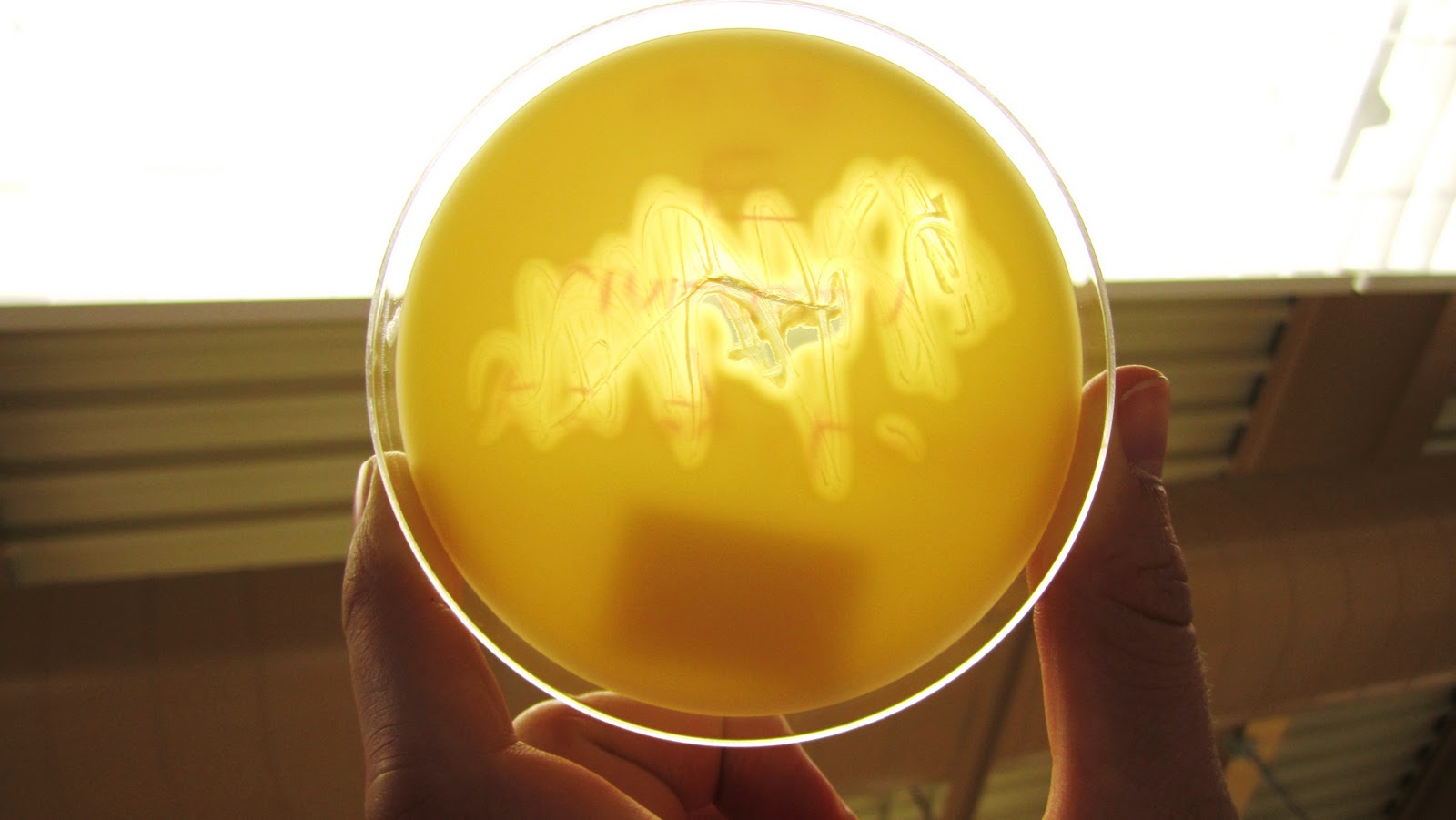 MicrobeDiscoveries: Starch, Lipid, Casein, and Motility Results