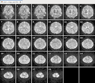 =Vision Group fMRI analysis guide=: Ring Stimulation with Single Shot ...