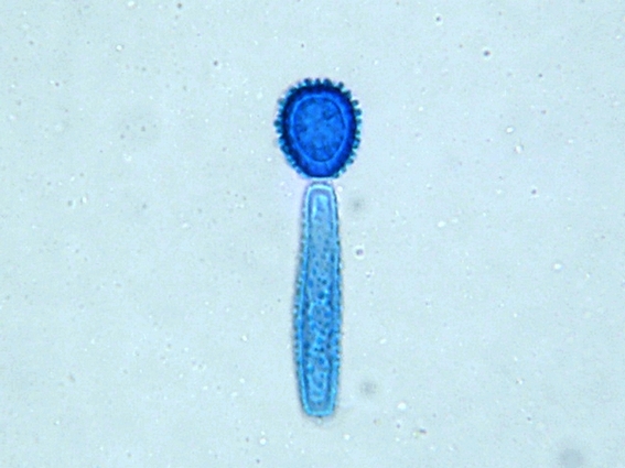 Fun With Microbiology (What's Buggin' You?): Sepedonium species