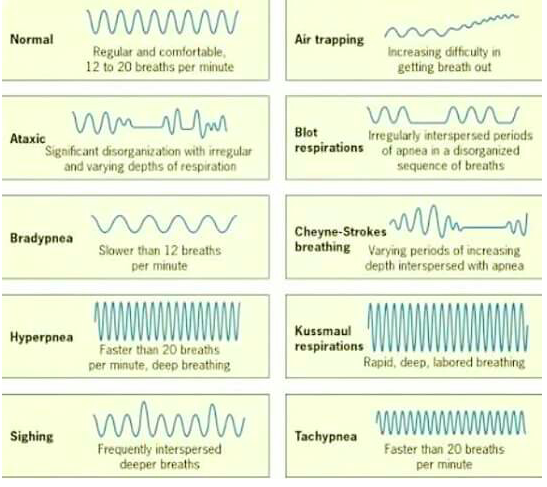 Semiologia tipos de respiración: Kussmaul, Cheyne-Stokes, Biot + VIDEO ...