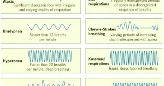 Semiologia tipos de respiración: Kussmaul, Cheyne-Stokes, Biot + VIDEO ...