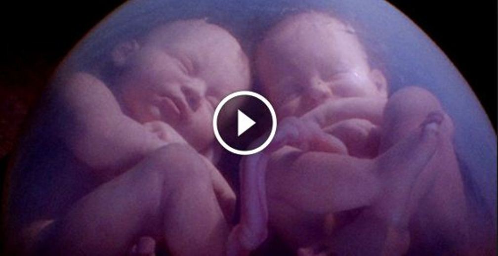 TWIN BABIES CAUGHT ON MRI SCAN FIGHTING IN THEIR MOTHER’S WOMB! AMAZING ...