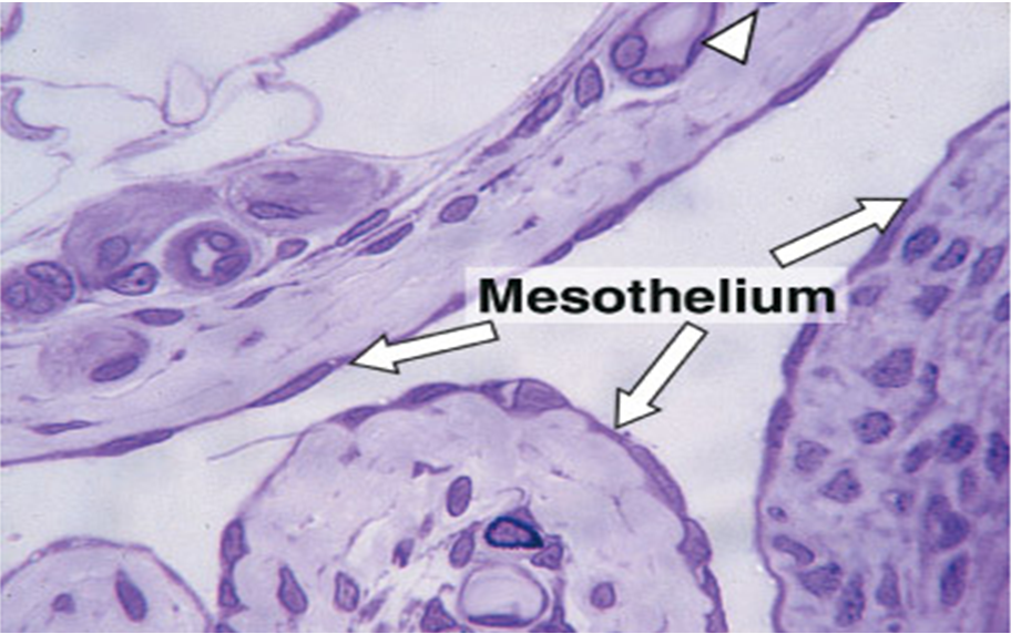 Mesothelium vs epithelium | - Blog Hanz