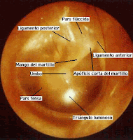 Detrás de la consulta: Otoscopia